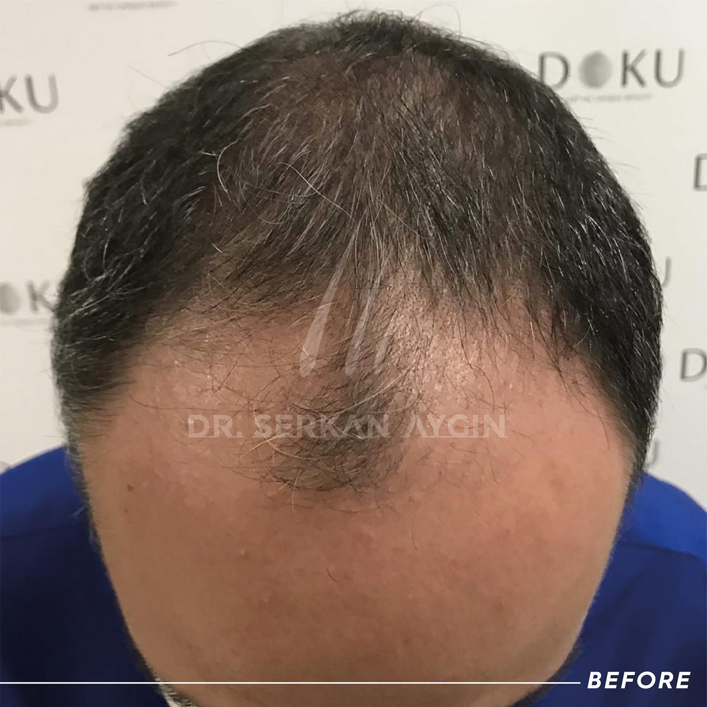 New Services - Clinică Implant Păr