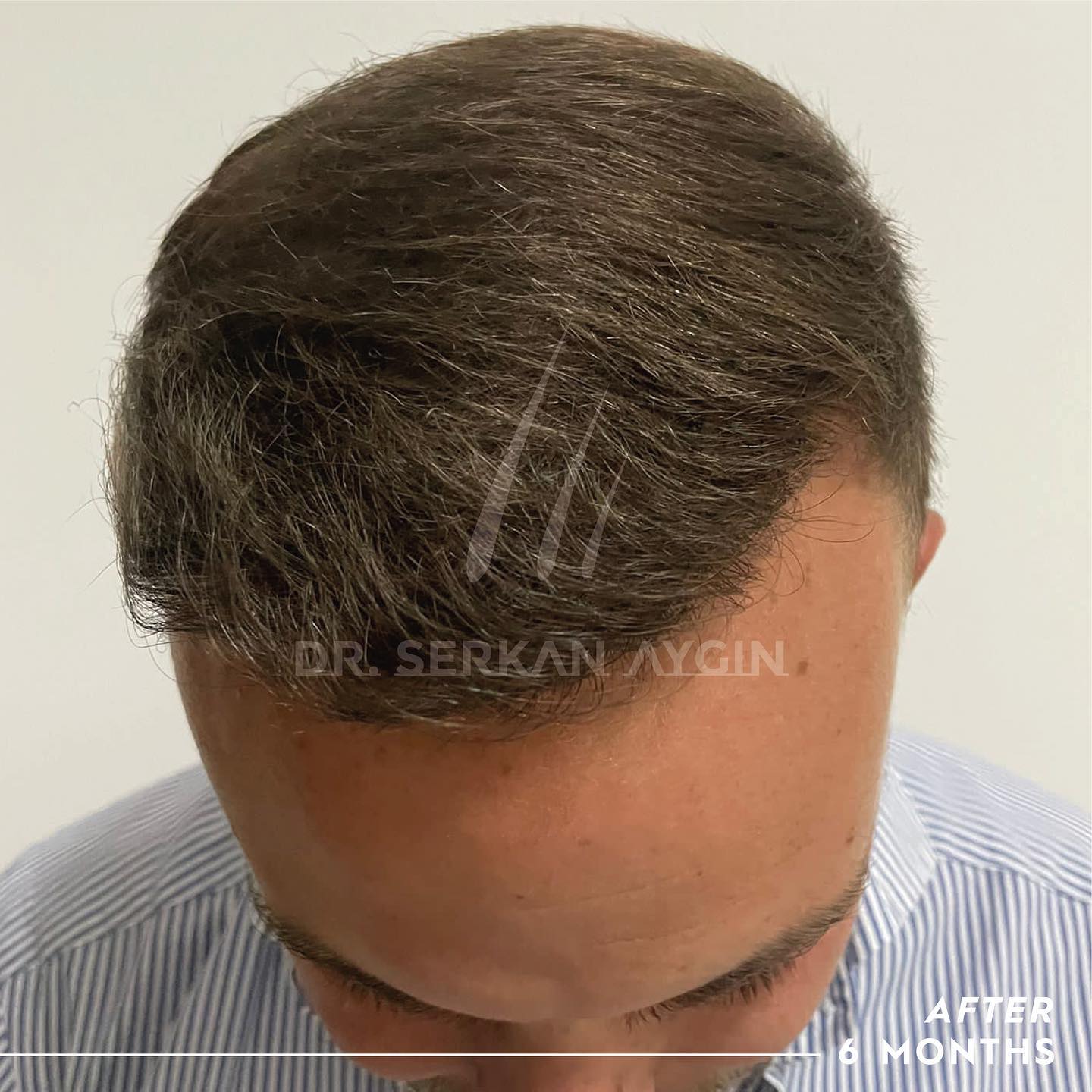 New Services - Clinică Implant Păr