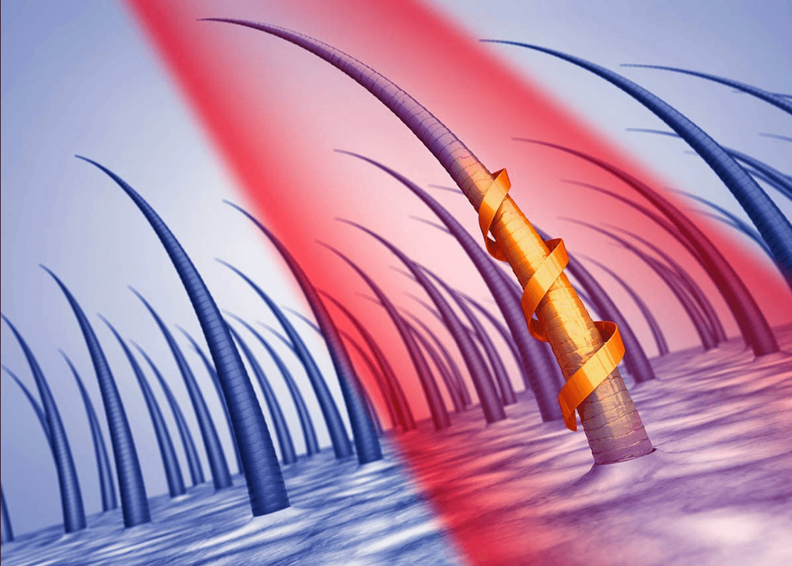 Terapia Laser - Low Level Laser Terapy, Terapia PRP și Mezoterapia ...